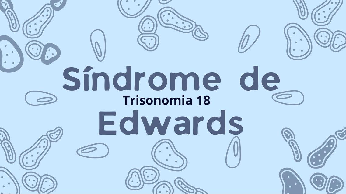 Síndrome de Edwards | Vidal Rodriguez | uDocz