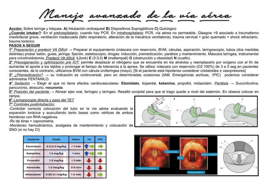 Manejo Avanzado de la Vía Aérea | Nicole Cabrera | uDocz