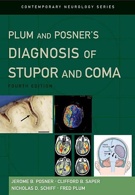 Plum and Posners Diagnosis of Stupor and Coma | Jonathan Moreno | uDocz