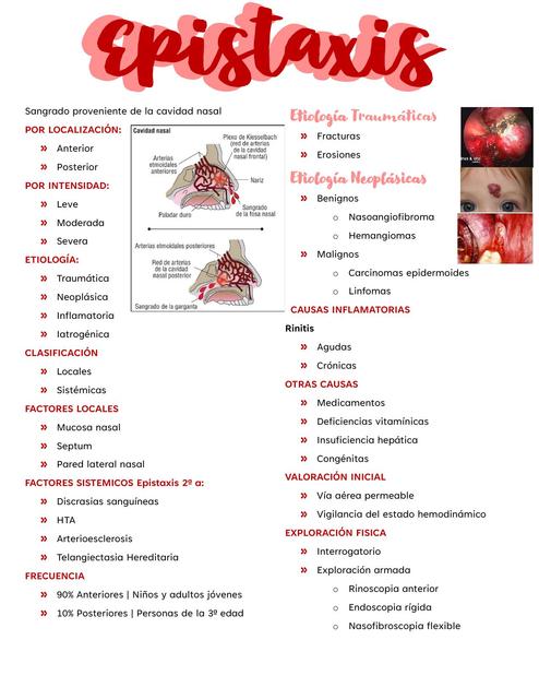 Epistaxis | Tania Duque García | uDocz