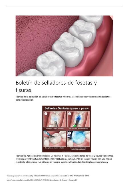 Boletín de selladores de fosetas y fisuras | Simone | uDocz