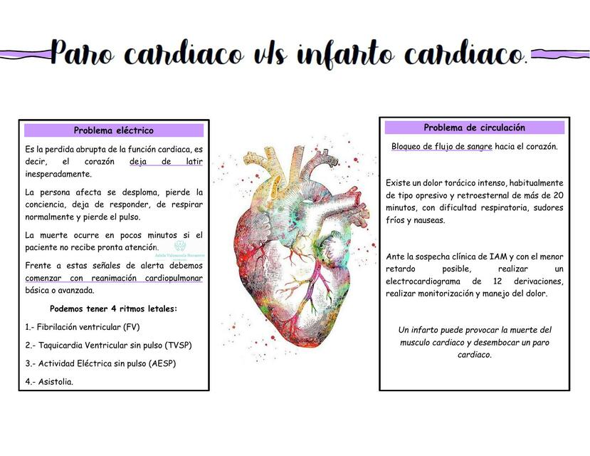 Paro Cardíaco v/s Infarto Cardíaco | Ari Valenzuela | uDocz