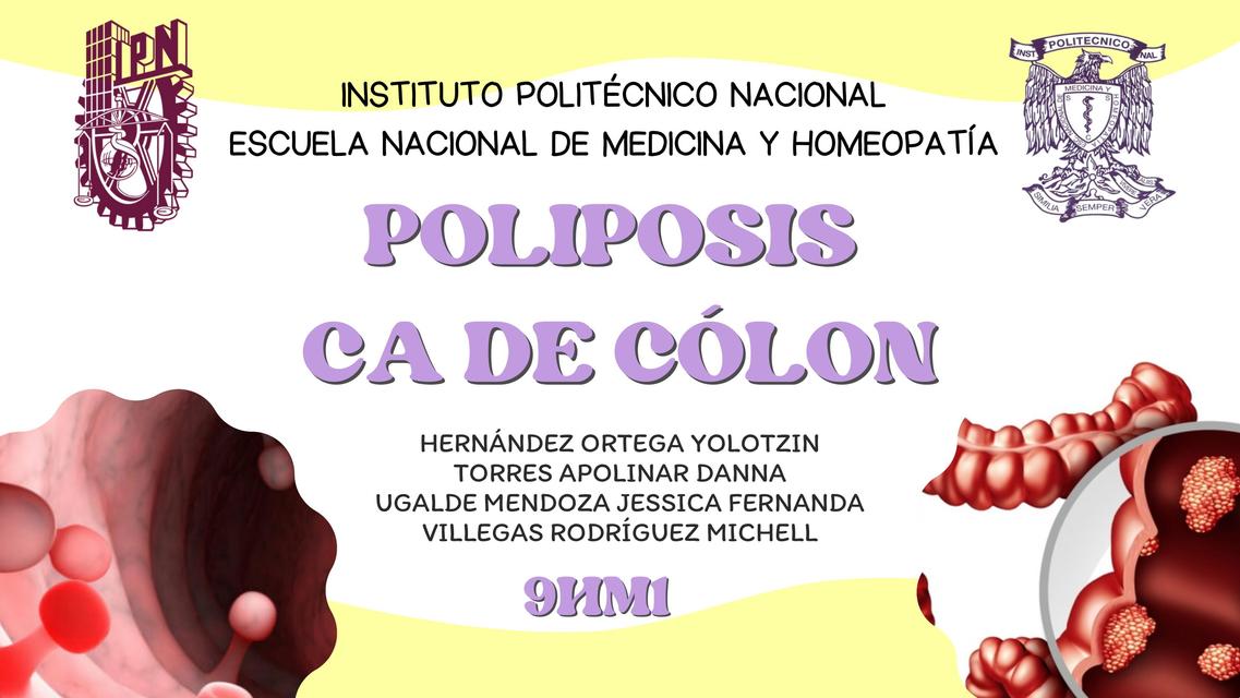 Poliposis ca de colon | Danna Torres | uDocz