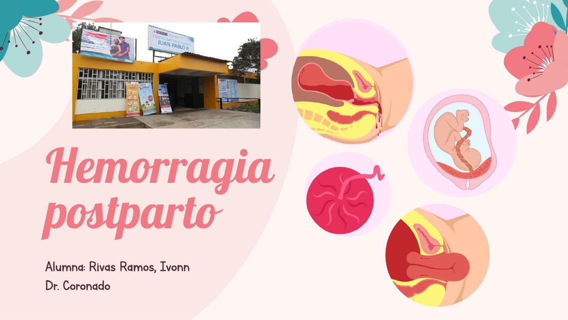 Hemorragia Postparto | María Gaudet | uDocz