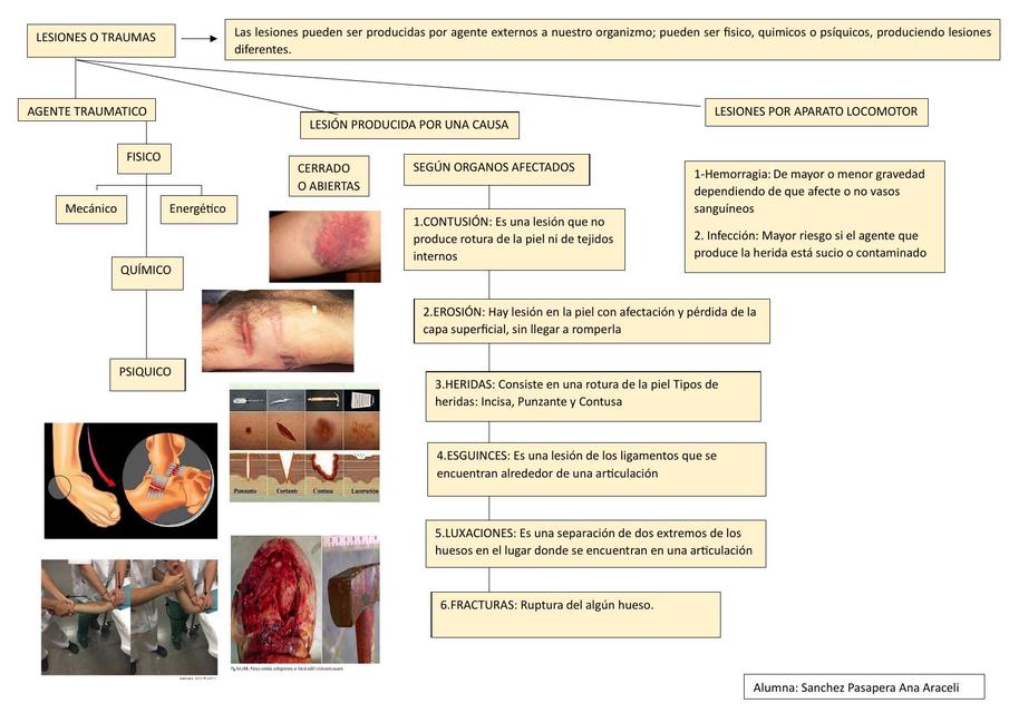 lesiones de trauma | Ana Sánchez | uDocz