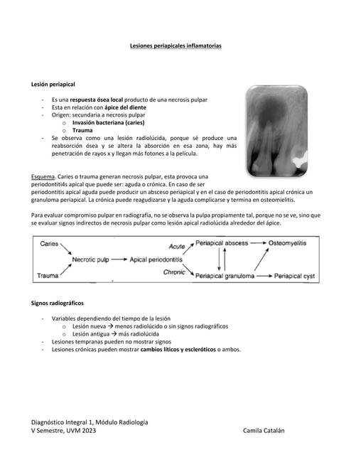 Lesiones periapicales inflamatorias | Cami Catalán | uDocz