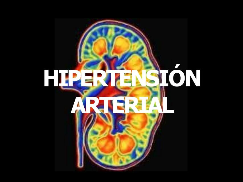 8 Fisiopatologia de la HTA | LiquidOH愛 | uDocz