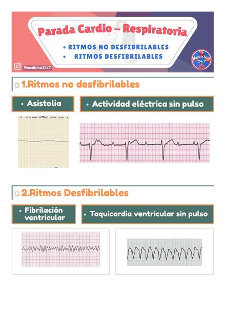Causas reversibles de parada cardiorrespiratoria - Ritmos ...