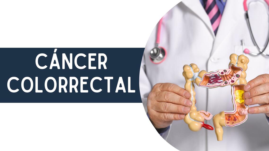 Cáncer colorrectal | Anayeli Correa Zegarra | uDocz