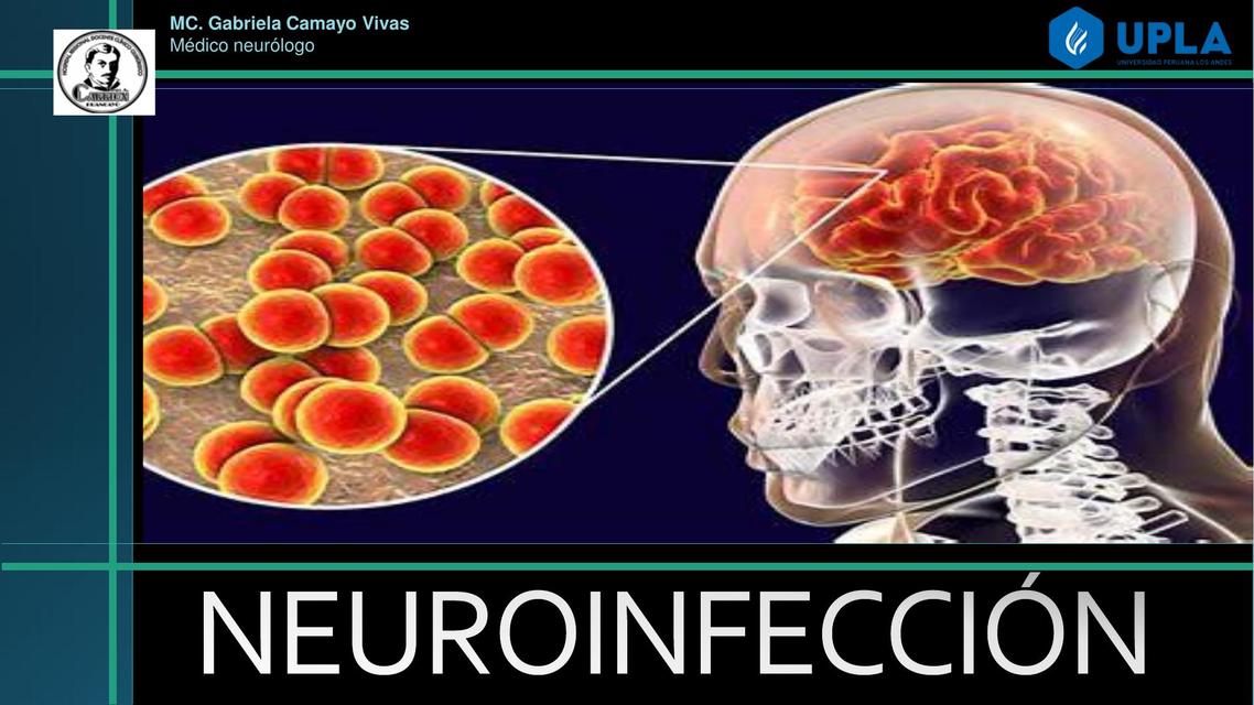 Neuro infección | DENISSE JOHANA PEZUA INCA | uDocz
