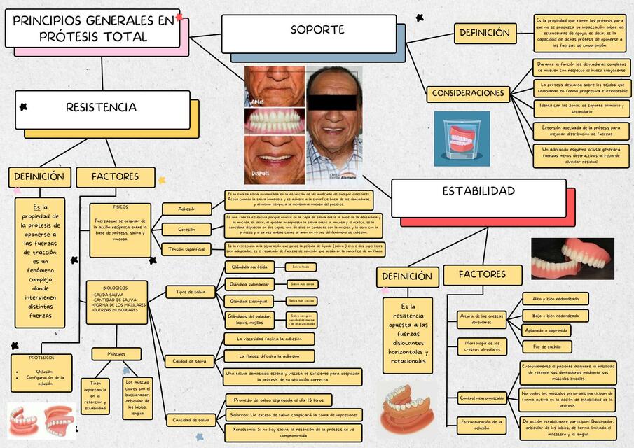 Principios Generales en Prótesis Total | Fiorella Vega | uDocz
