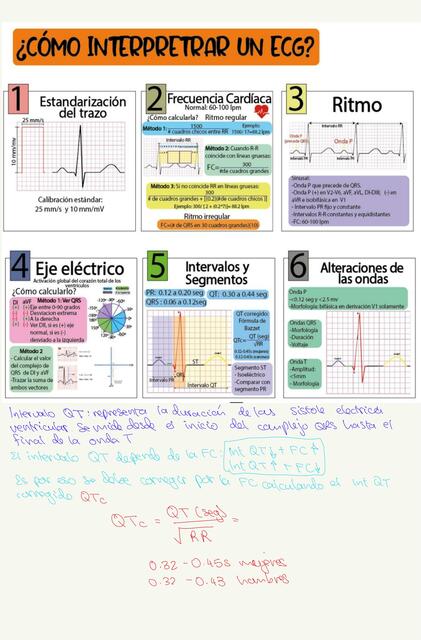 ¿Cómo Interpretar un ECG? | Passion for cardiology | uDocz
