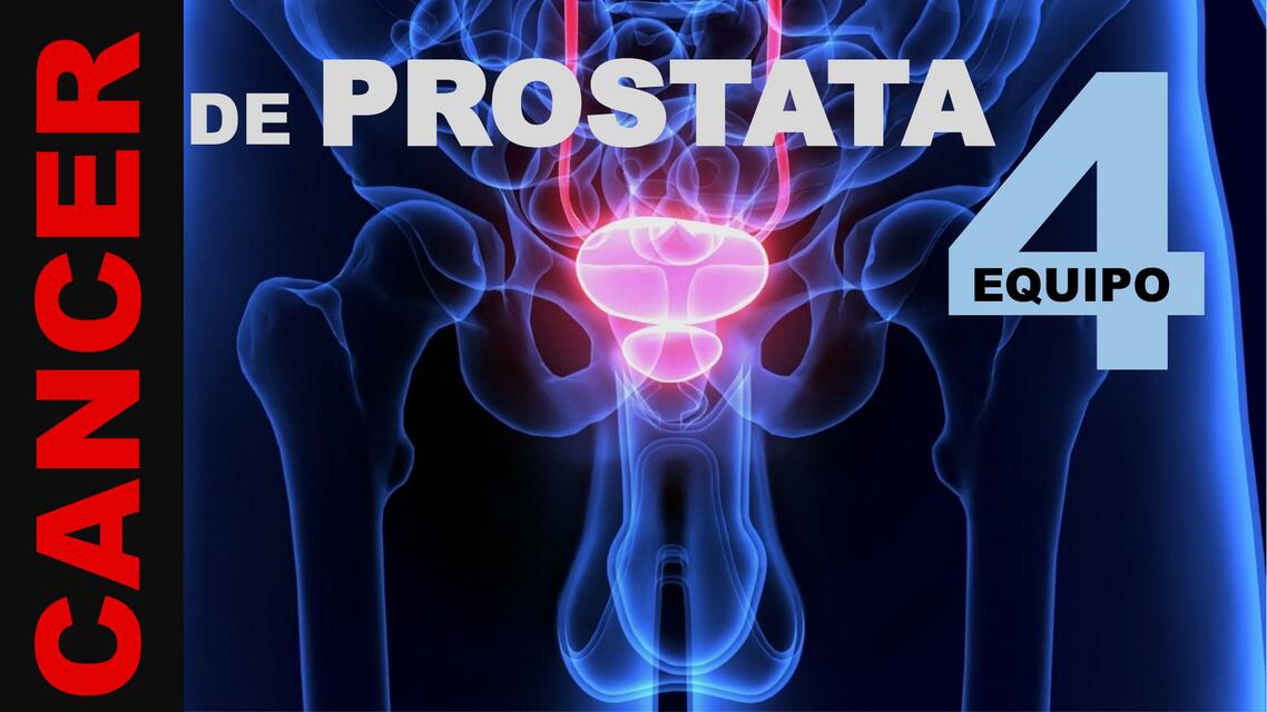 Cáncer de Próstata | Adriana Rosas | uDocz