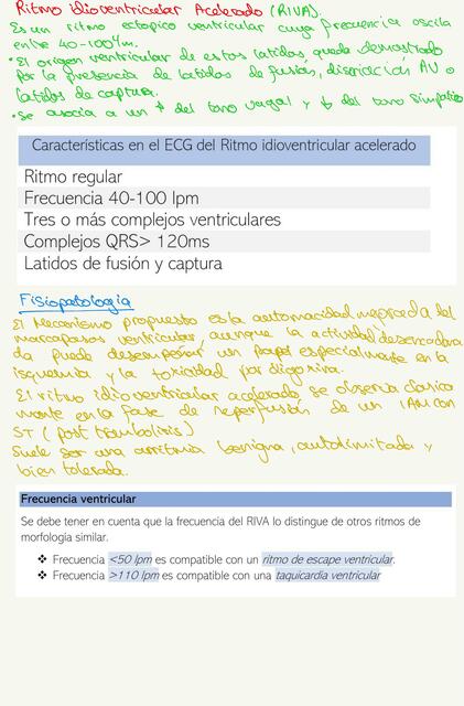 Ritmo Idioventricular acelerado o RIVA (arritmia postrombolisis ...