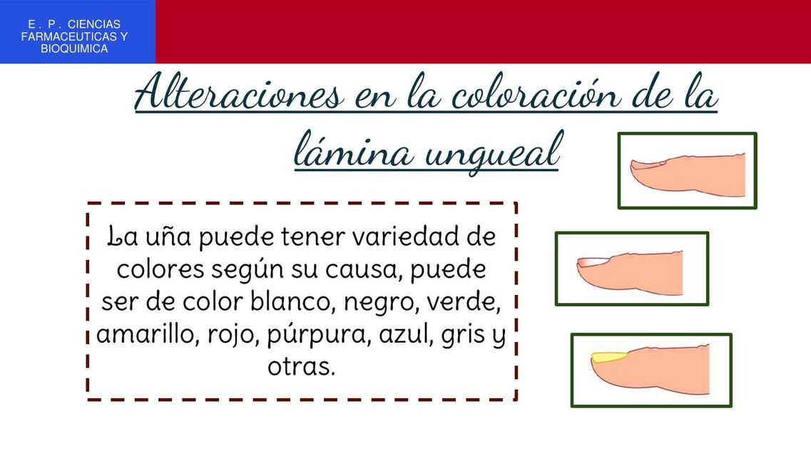 Alteraciones en la coloración de la lamina ungueal | Ange Nc | uDocz