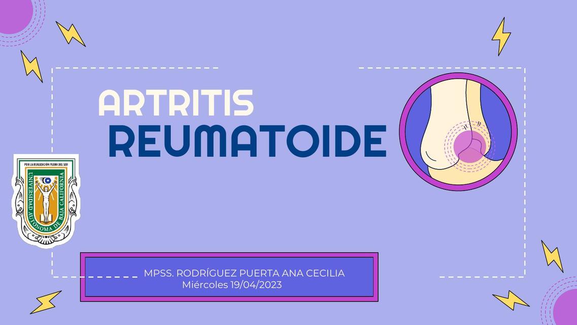 Artritis Reumatoide | Ana Cecilia Rodríguez | uDocz