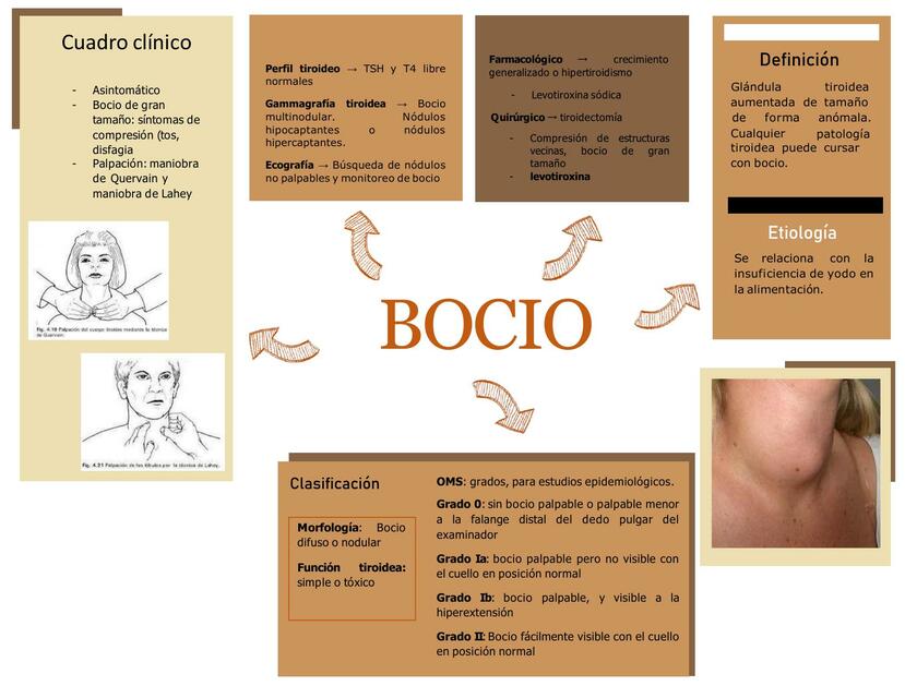 Bocio y nódulos tiroideos | Yelser PV | uDocz