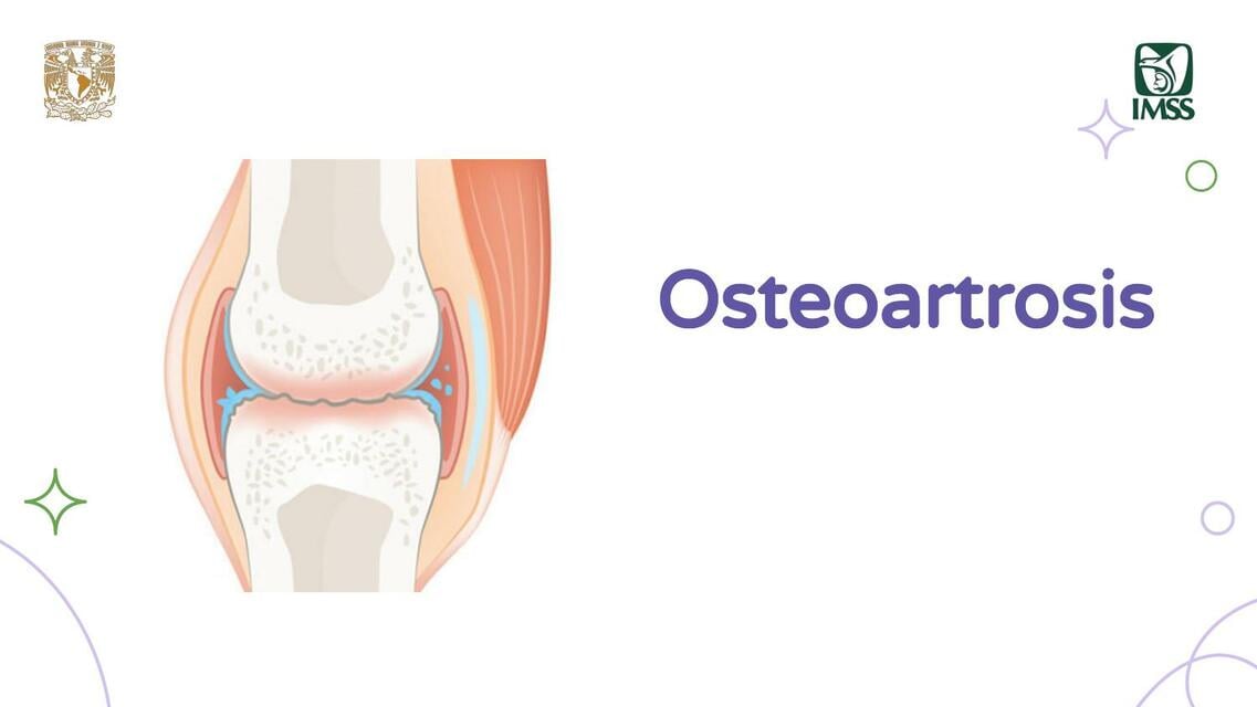 Osteoartrosis | Jessica Aguilar | uDocz