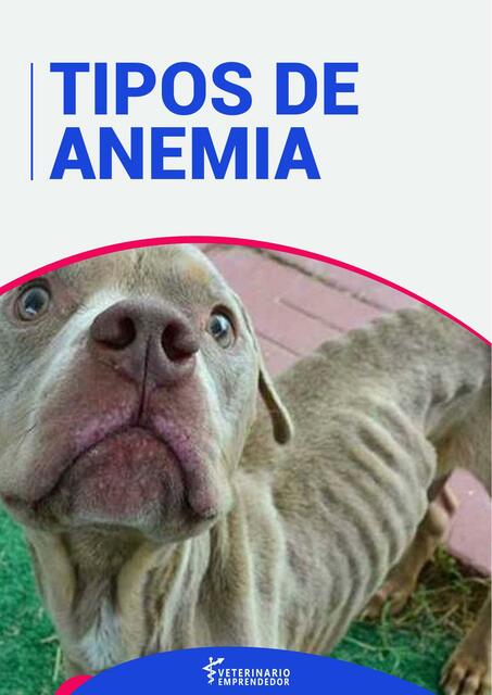 Tipos de Anemia Comercial | luke pizarro | uDocz