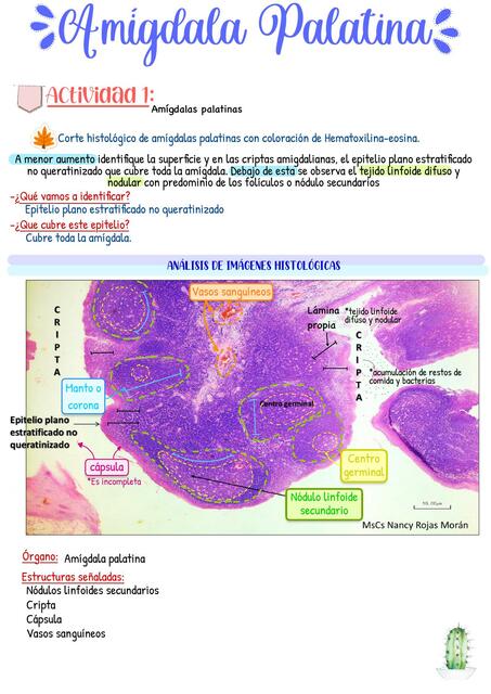 Histología De Las Amígdalas Faríngeas