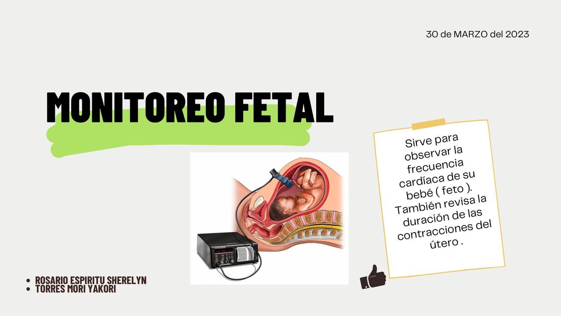 Monitoreo Fetal | TenySpica | uDocz