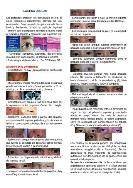Plástica Ocular | Mary Mednotes | uDocz