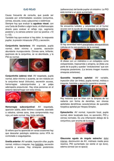 Ojos Rojo | Mary Mednotes | uDocz