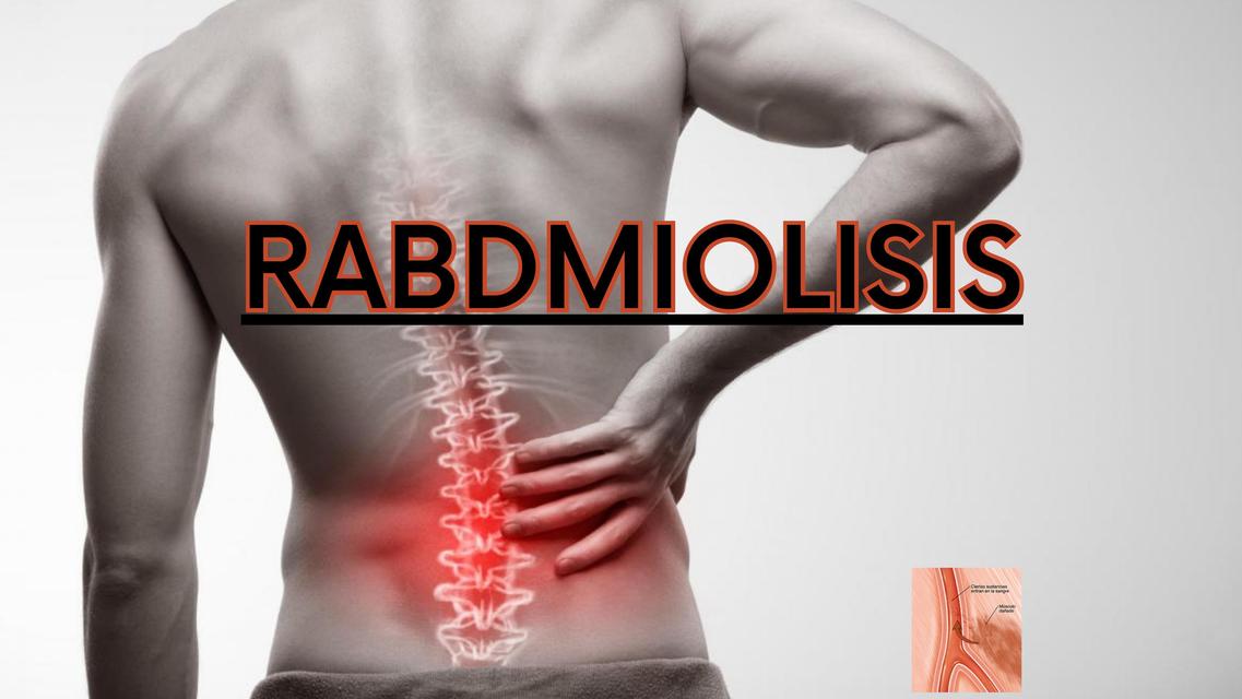 Rabdomiólisis | mar | uDocz
