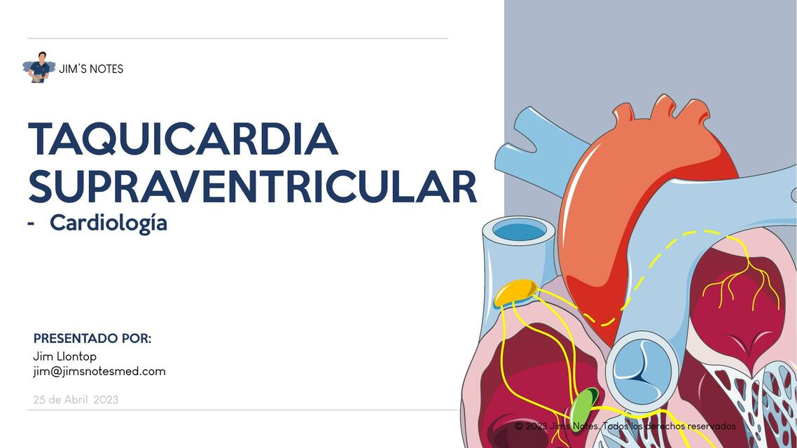 TAQUICARDIA SUPRAVENTRICULAR | Jim Llontop | Jims Notes | uDocz