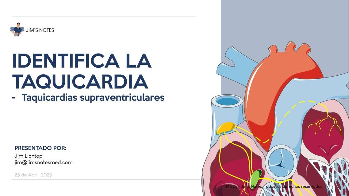 Identifica la Taticardia | Jim Llontop | Jims Notes | uDocz