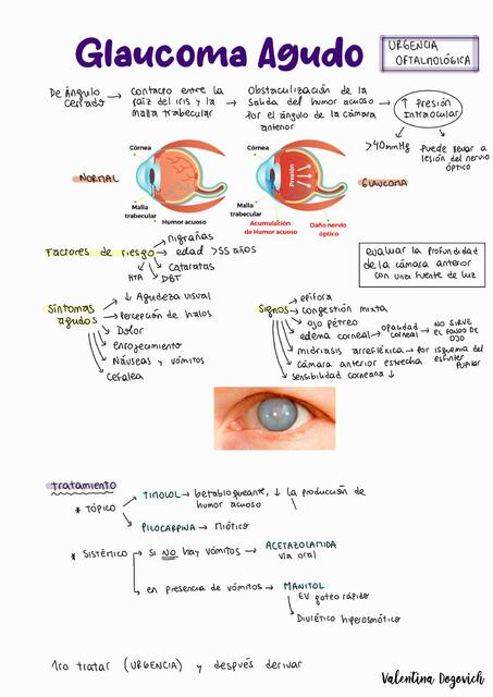 Glaucoma Agudo | Valen Dogovich | uDocz