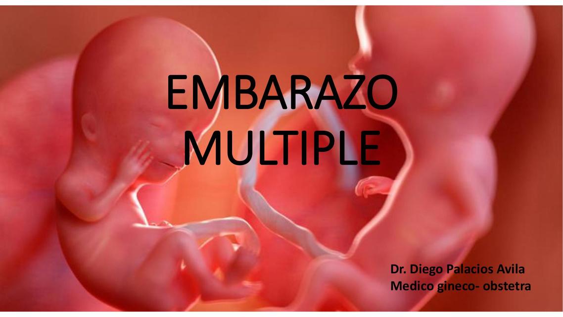 Embarazo Múltiple | Diego Palacios Avila | uDocz