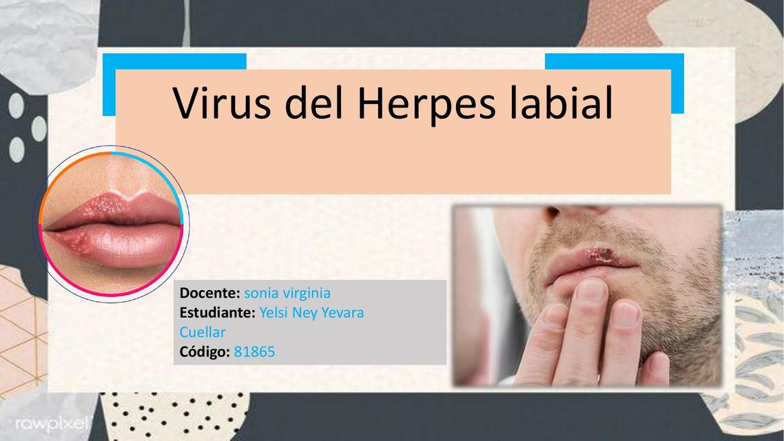Virus del herpes labial | YELSI NEY YEVARA CUELLAR | uDocz