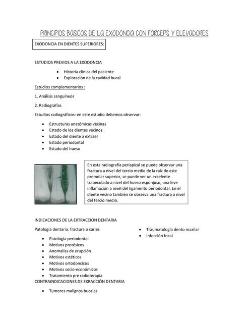 Principios Básicos De La Exodoncia | Ameli | uDocz