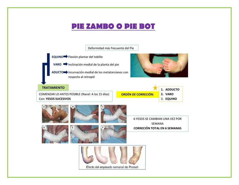 PIE ZAMBO O PIE BOT | Fiorella Saldaña Alvarado | uDocz