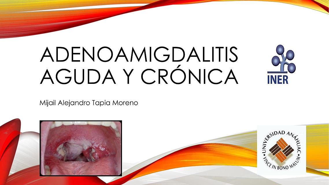 Adenoamigdalitis aguda (faringoamigdalitis) | Dr. Mijail Tapia Moreno ...