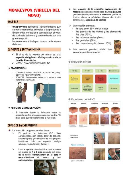 Monkeypox (Viruela del Mono) | Haziel Lamadrid | uDocz