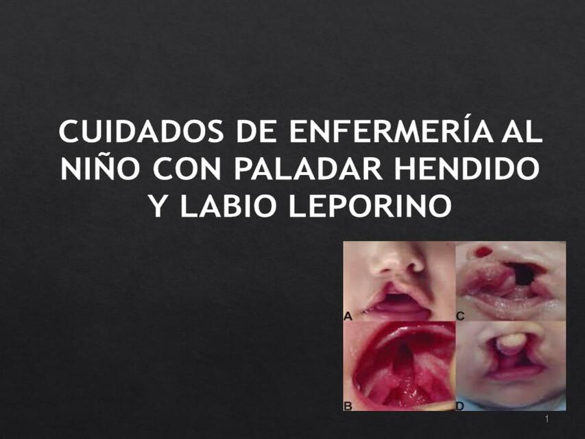 LABIO LEPORINO PEDIATRIA | uDocz | uDocz