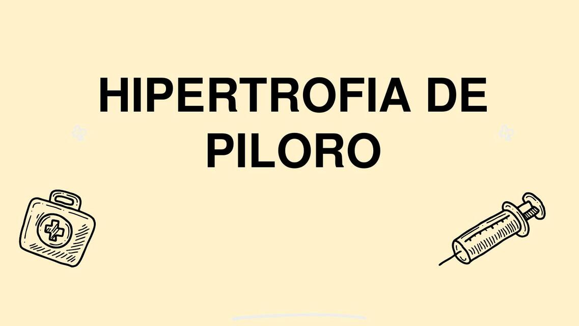 Hipertrofia De Píloro -Cirugía Pediátrica | MiddleMedic | uDocz