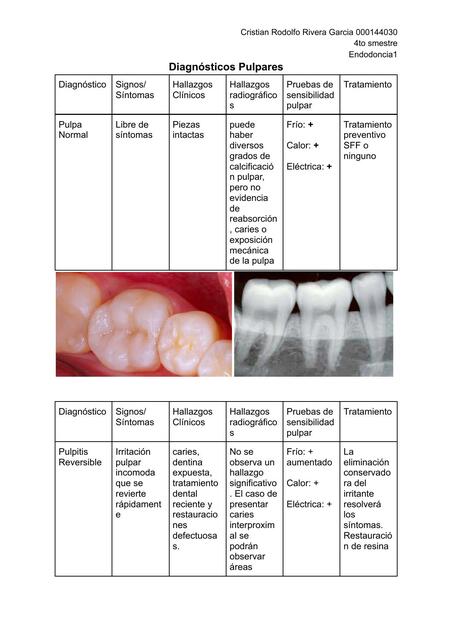Diagnósticos pulpares y periapicales Final | Cristian Rodolfo Rivera ...