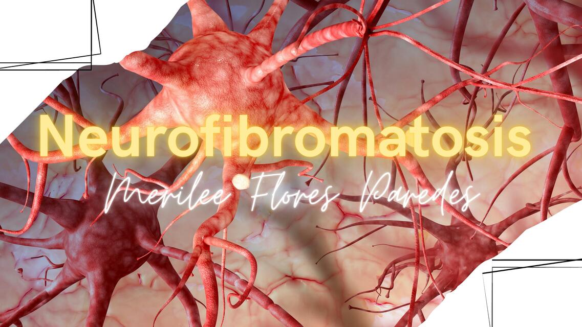 Resúmenes de Neurofibromatosis | Descarga apuntes de Neurofibromatosis