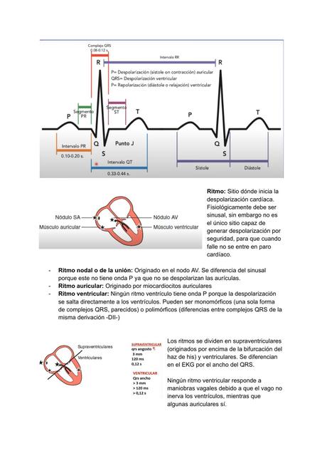 Arritmias e isquemia 1 | TANIA ARIAS | uDocz