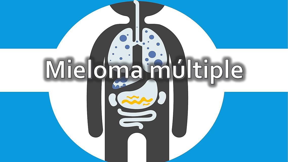 Miolema múltiple | ANDREA FERNANDA QUISPE HUAMANÍ | uDocz