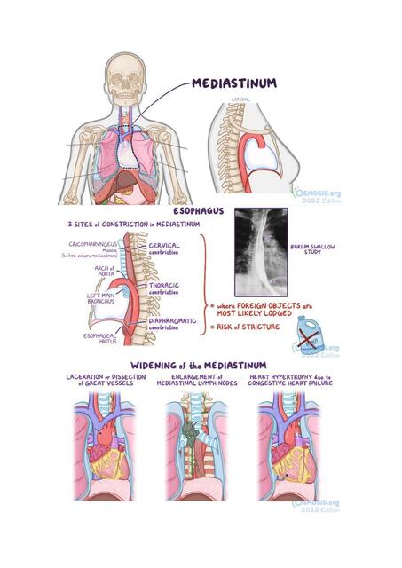 Mediastinum Osmosis | Dra Kim | uDocz