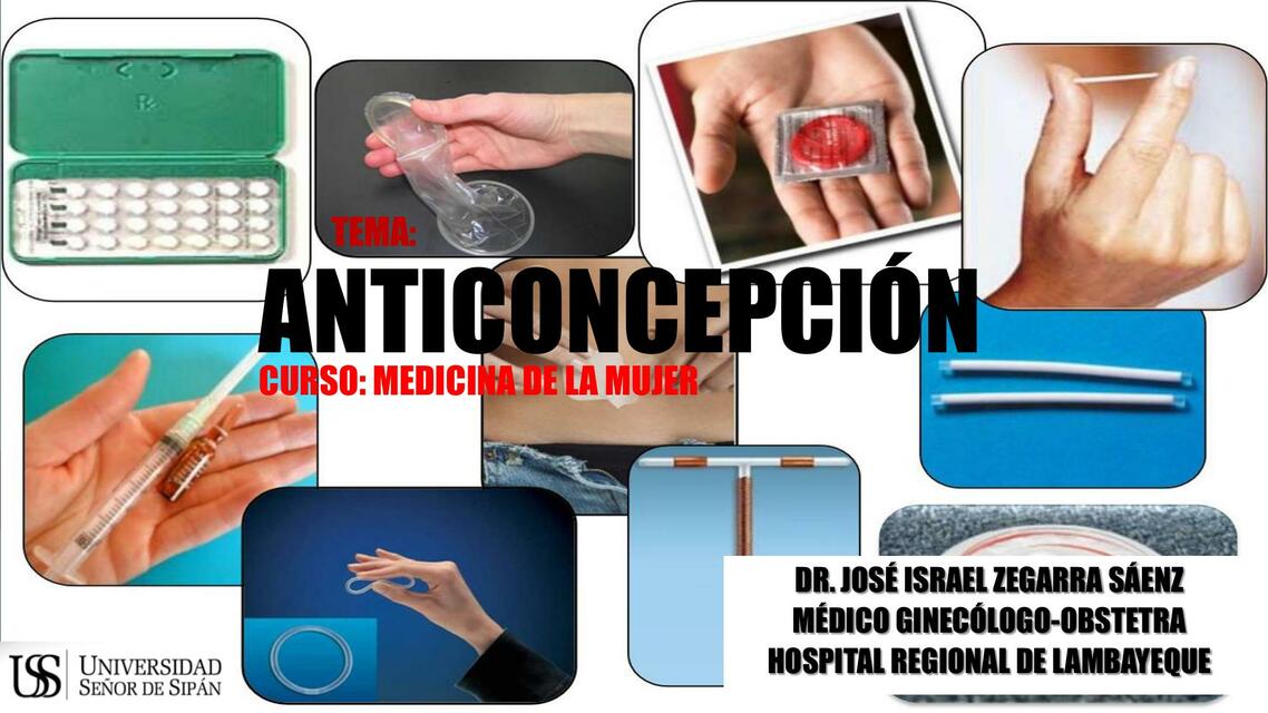 Anticoncepción | Gustavo Herrera | uDocz