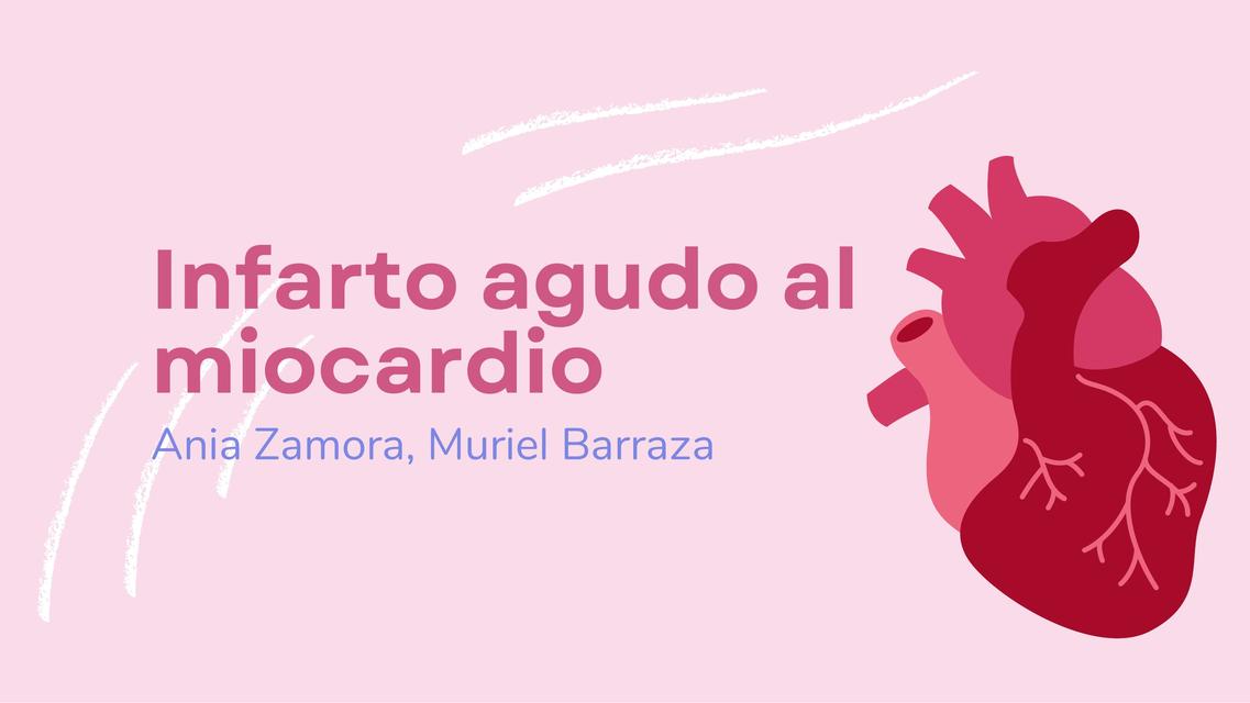 Infarto agudo al miocardio | aniasstudy | uDocz