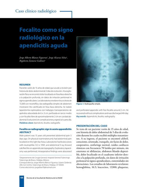 Fecalito como signo radiológico en la apendicitis aguda | Cesar ...
