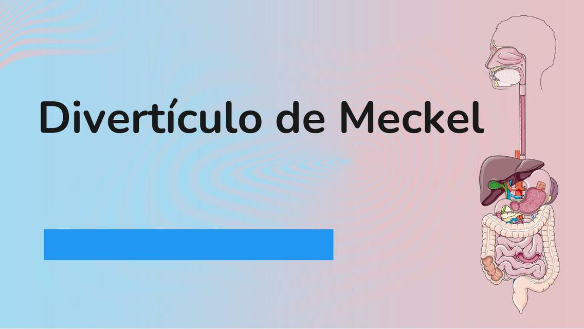 Flashcards de DIVERTICULO DE MECKEL Y INVAGINACION INSTESTINAl | Por G ...