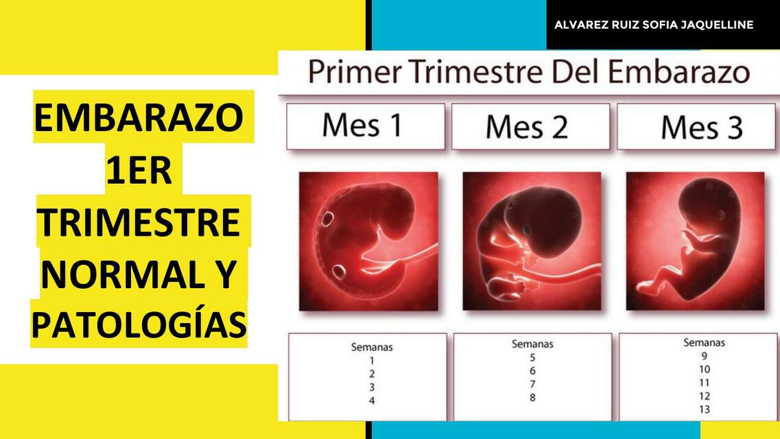 EMBARAZO 1ER TRIMESTRE NORMAL Y PATOLOGIAS | SJAR | uDocz