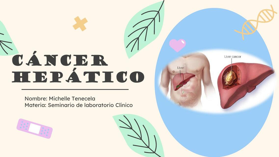 Cáncer Hepático | michelle tenecela | uDocz